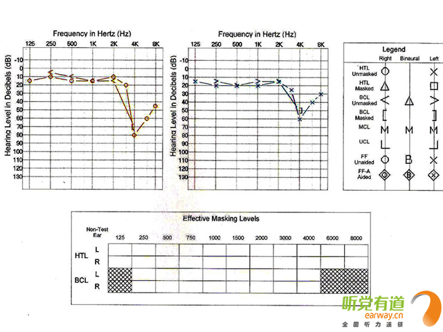 纯音听力图怎么看? 听力学知识 助听器品牌助听器价格纯音听力计 聆康听力集团听觉有道官网